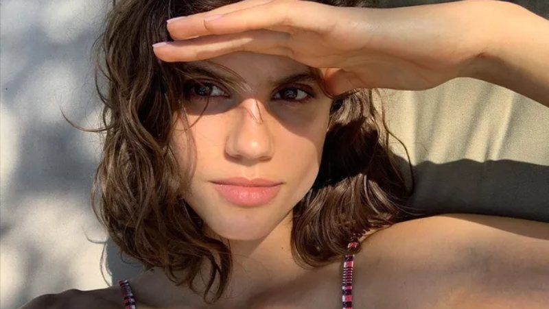 Alergija na sunce: šta je fotodermatitis i kako utvrditi da li ga imate ...